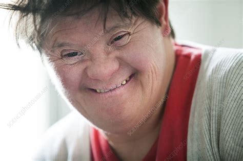 Down Syndrome Elderly