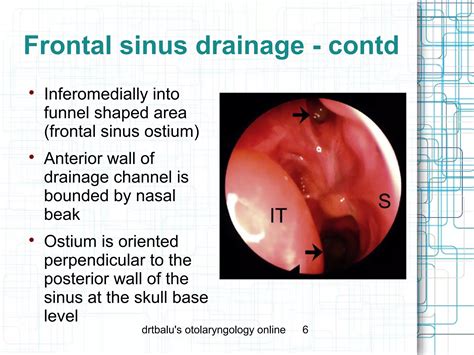 Radiological Anatomy Of Frontal Sinus Ppt