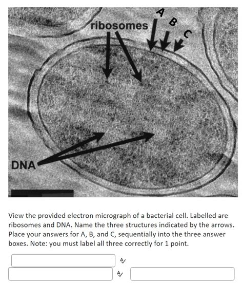 Ribosomes Electron Micrograph