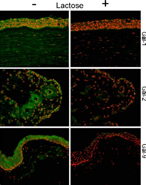 Lectin Histochemical Localization Of Tissue Reactivity For Galectins 1 Download Scientific