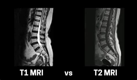 Contrast Media In Radiology Mri Ct And Pet Explained