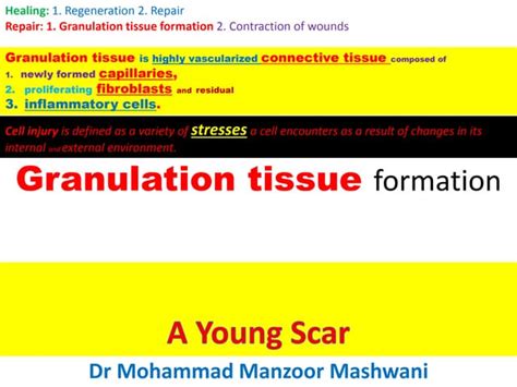 Granulation Tissue Formation Pptx