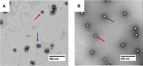 Comparative Tem Analysis Of Raav Produced In Hek293sf Cells And