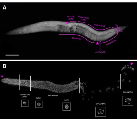 C Elegans Gonad Dissection And Freeze Crack For Immunofluorescence And Dapi Staining