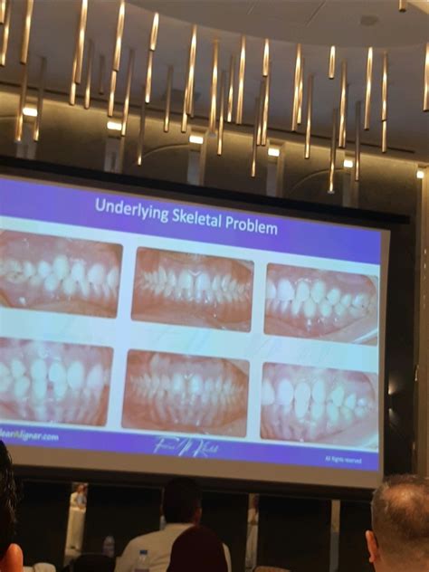 Dr Majd Al Farra On Linkedin Dubaidentist