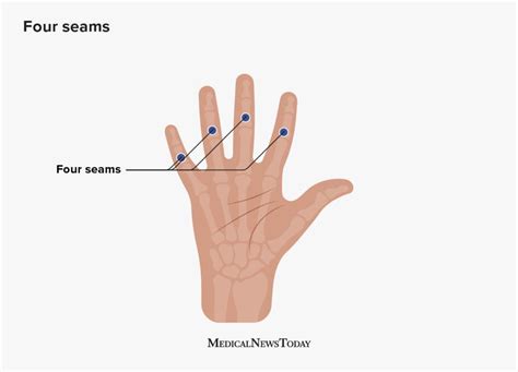 Hand Pressure Points Chart And Uses