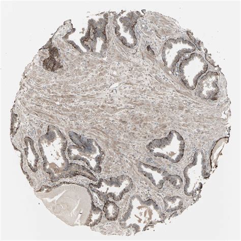 Tissue Expression Of Cd276 Staining In Prostate The Human Protein Atlas