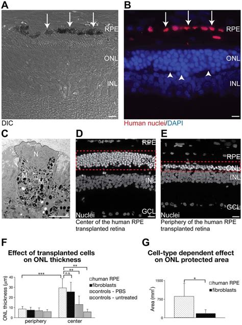 Transplantation Of Hesc Derived Rpe Cells Effectively Rescues