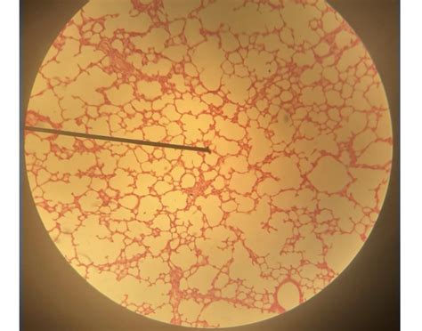 Lung Microscope Quiz