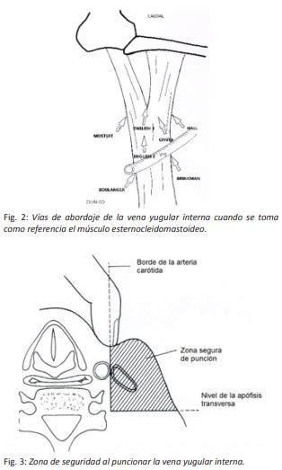 Anatomía De La Yugular Interna