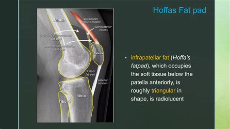 X Ray Knee Joint Pptx