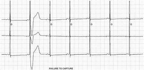 Troubleshooting Interpreting Diagnostic Information To Ensure