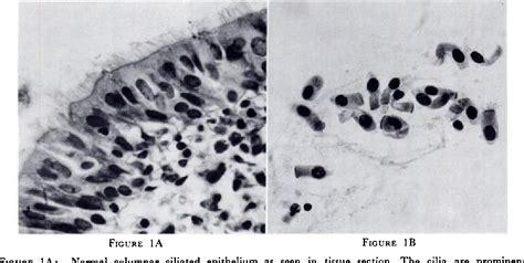 Ciliated Epithelial Tissue