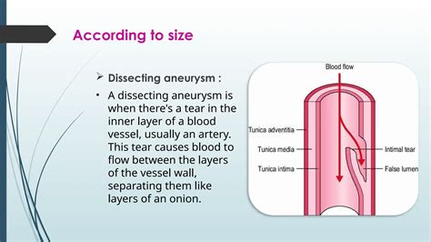 Aneurysm Classification Of Aneurysm And Causes Of Aortic Aneurysm Ppt