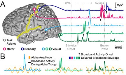 Eeg Brain Scan