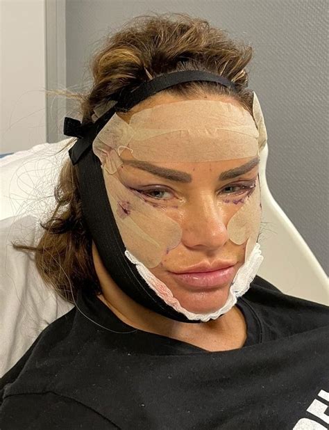 Katie Price A Surgery Veteran No Way Say These Cosmetic Op