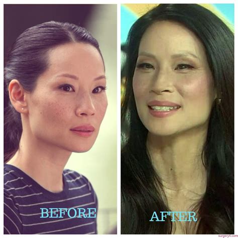 Lucy Liu Plastic Surgery Photos Before And After Surgery4