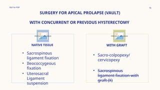 Sacrospinous Ligament Fixation For Pelvic Organ Prolapse Latest