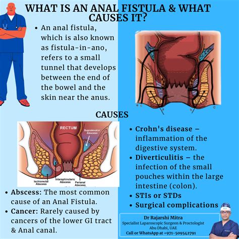 Dr Rajarshi Mitra Specialist Laparoscopic Surgeon And Proctologist Abu