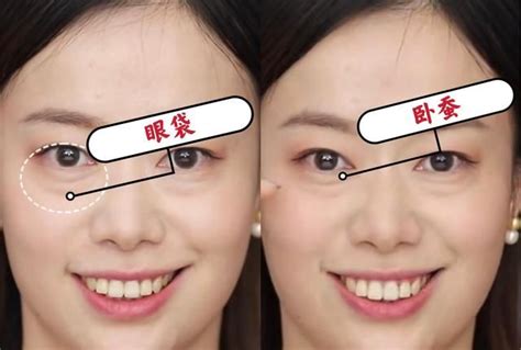 眼部审美｜你适合哪种卧蚕