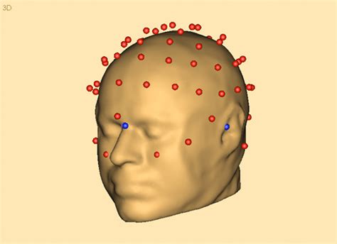 Besa® Brain Electrical Source Analysis Features Coregistration