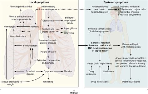 Disseminated Tuberculosis Causes Symptoms Treatment