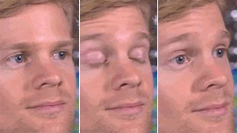 Famed Blinking Guy Raising Money For Ms