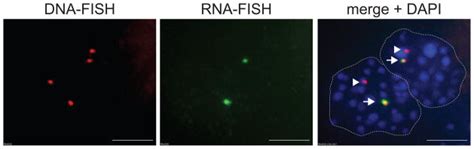 Random Monoallelic Expression Regulating Gene Expression One Allele At