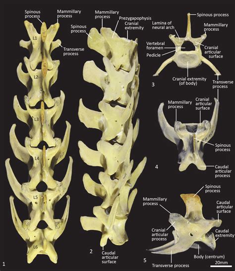 Lumbar Vertebrae Sama M1960 1 Complete Lumbar Series L1 L6 Dorsal