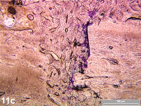 Histology Of The Fracture Callus At 6 Weeks Postfracture Gap Callus In