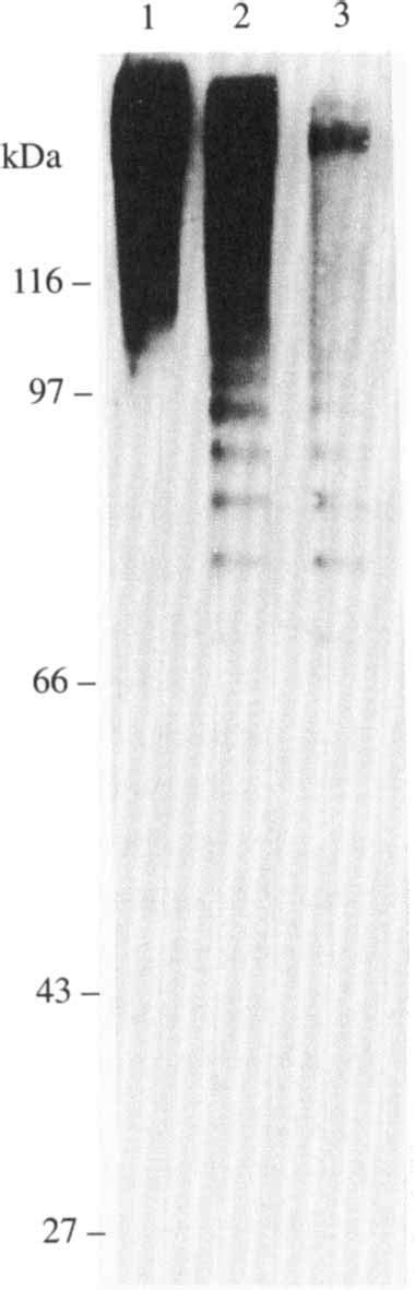 Western Blot Stained With Mab 1b12 Of A Partial Proteolytic Digest Of