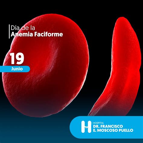 Especialista Moscoso Puello Identifica Síntomas De La Anemia Falciforme