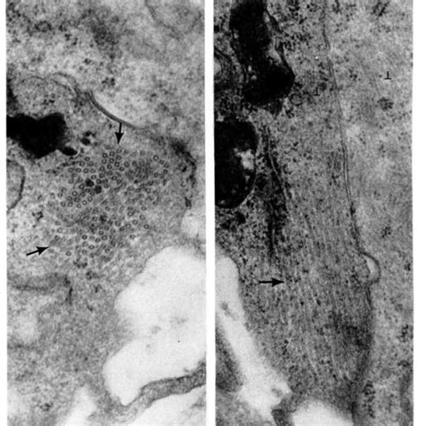Electron Micrograph Of Part Of Similar Embryo To One Shown In Fig 3