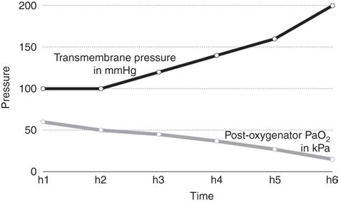 The Ecmo Circuit Chapter 3 Ecmo In The Adult Patient