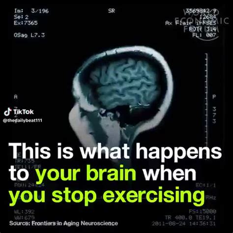 Sumali Abeyrathna Posted On Linkedin