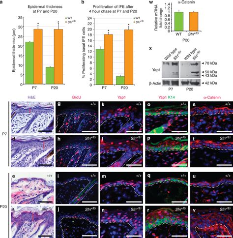 Sfn Er Interfollicular Epidermis Ife Is Hyperproliferative A Download Scientific Diagram