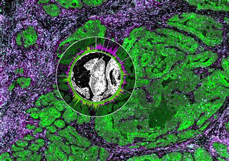 Ncounter® Custom Codeset Plus Nanostring