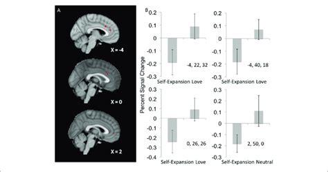 A Displays Sagittal Slices With The Locations Of Significant