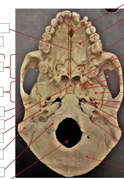 Inferior Skull Diagram Quizlet