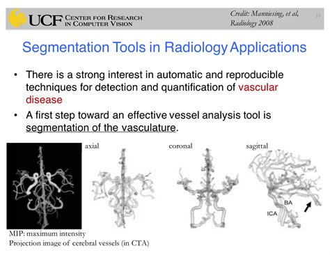 Lec7 Medical Image Segmentation I Radiology Applications Of Segmentation And Thresholding