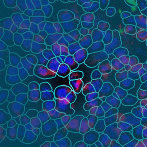 Research Focus Nanostring