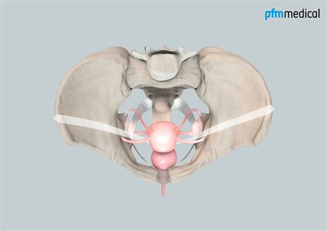 Tiloop Lls Dubuisson Mekalasi Oy