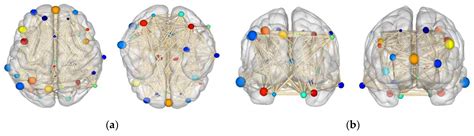 Multi Layer Graph Attention Network For Sleep Stage Classification Based On Eeg