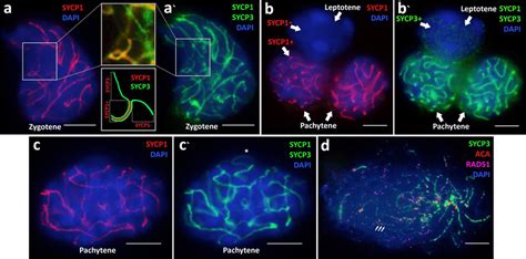 Synaptonemal Complexes Assembly And Double Strand Breaks Dsb Repair