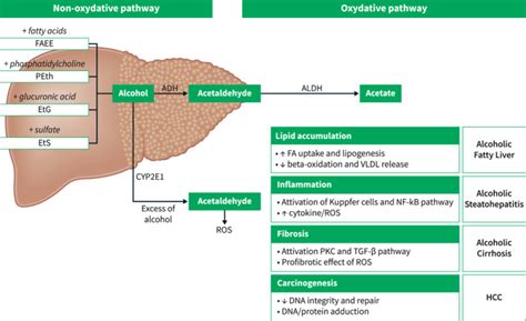 Influence Of Sex In Alcohol‐related Liver Disease Pre‐clinical And
