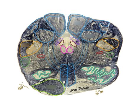 Brainstem Caudal Medulla Identification Diagram Quizlet
