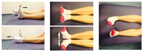 Lateral Malleolus Avulsion Fracture · Virtual Fracture Clinic