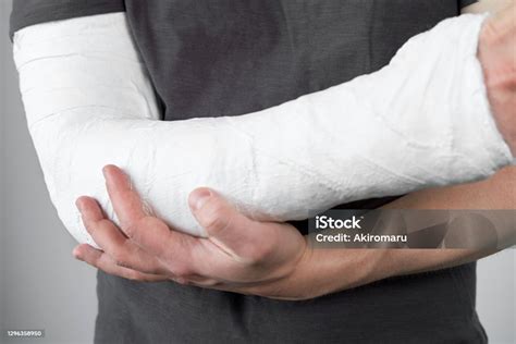Closeup View Of Mans Hand With Plaster Cast On A White Wall Background