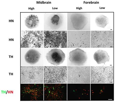 Midbrain And Forebrain Neural Stem Cells Nscs Were Pre Differentiated Download Scientific