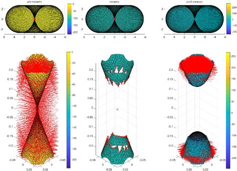 figure 1 from numerical surgery for mean curvature flow of surfaces